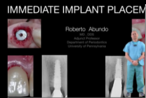 Immediate Implant placement – DentalmedTV